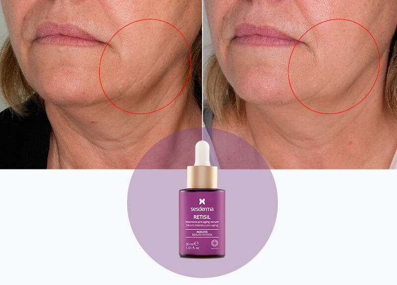 Sesderma | RETISIL